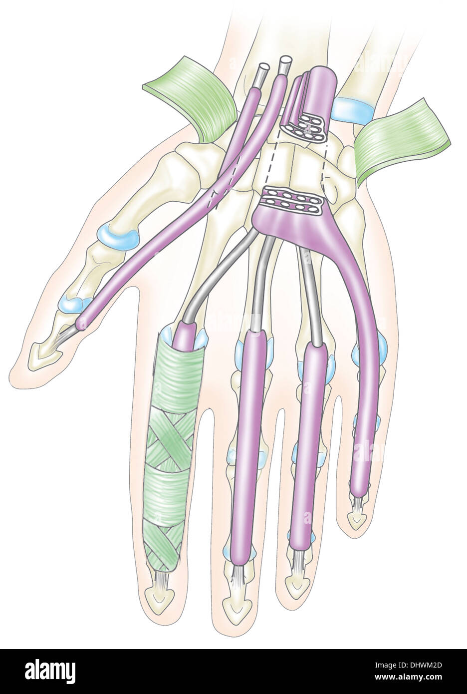 Mano anatomia disegni ossa immagini e fotografie stock ad alta ...