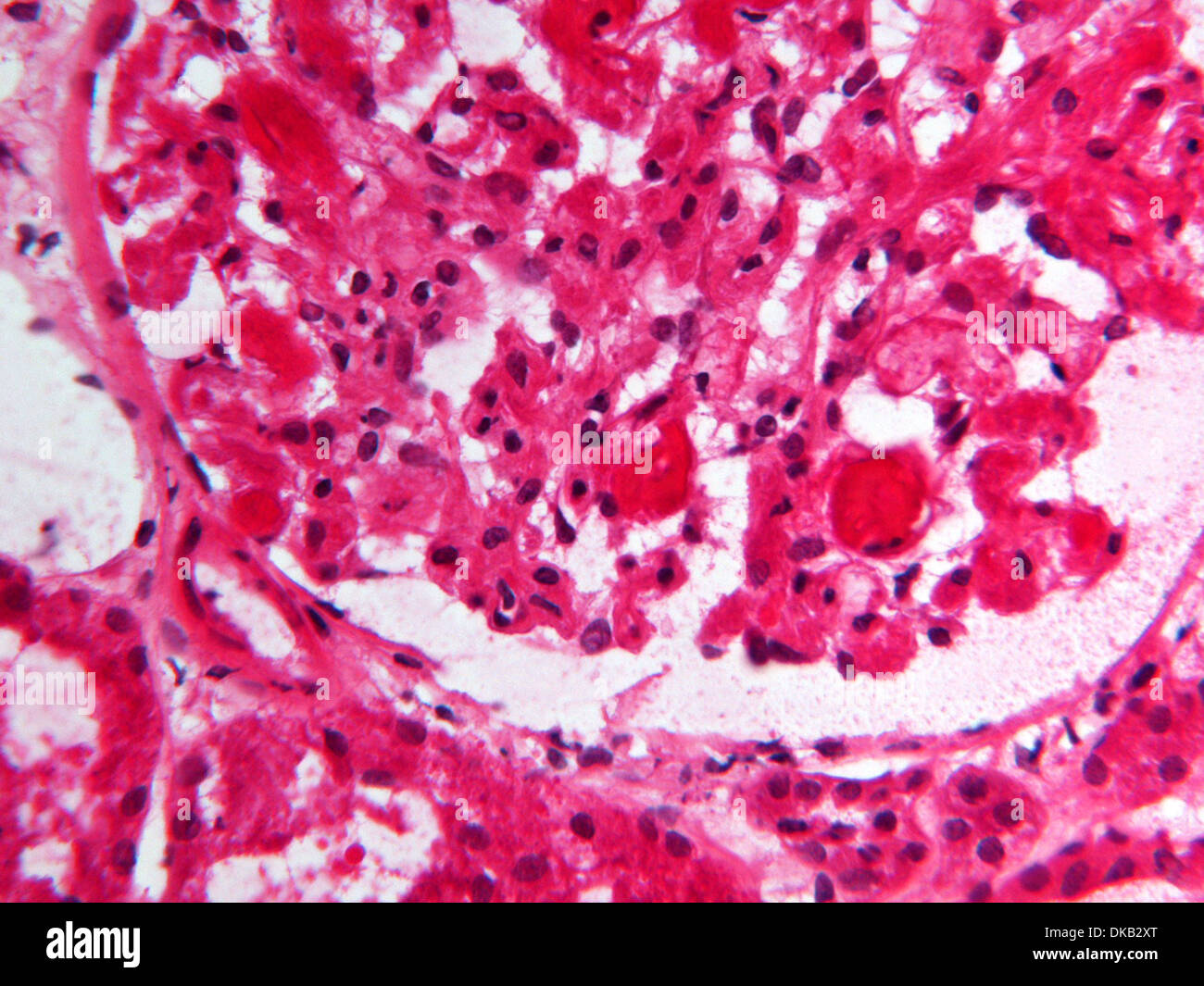 Anatomia del glomerulo del rene immagini e fotografie stock ad alta ...