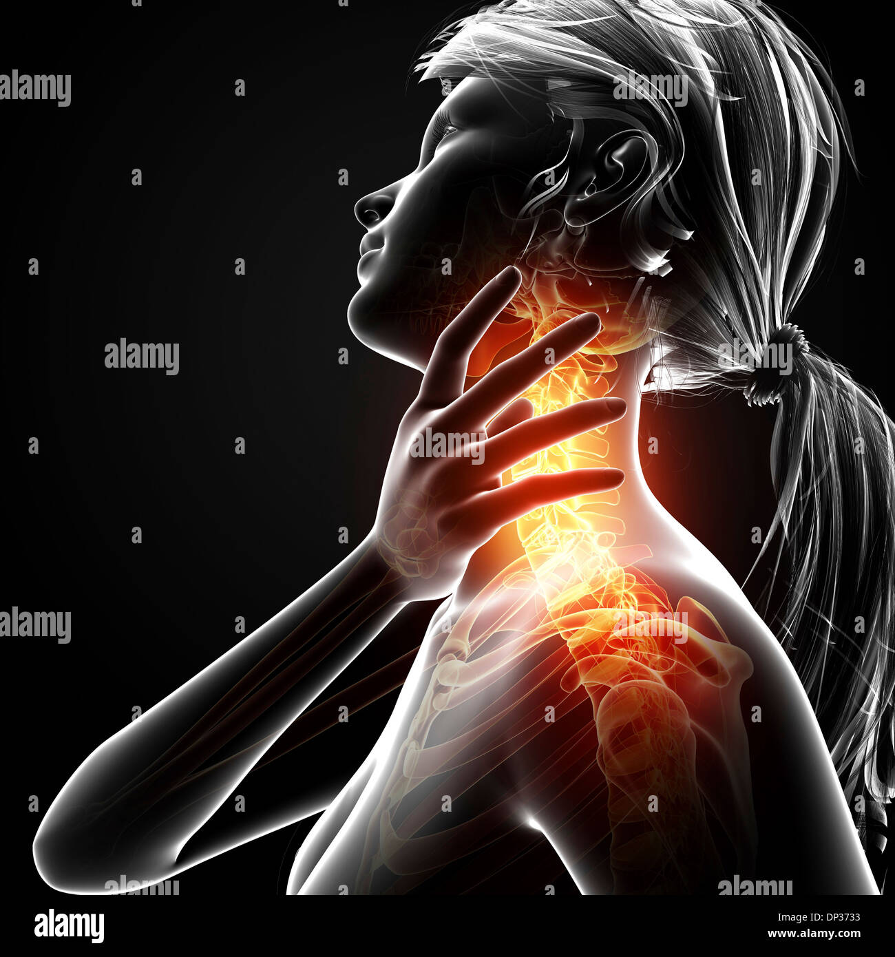 Radiografia anormale del collo immagini e fotografie stock ad alta ...