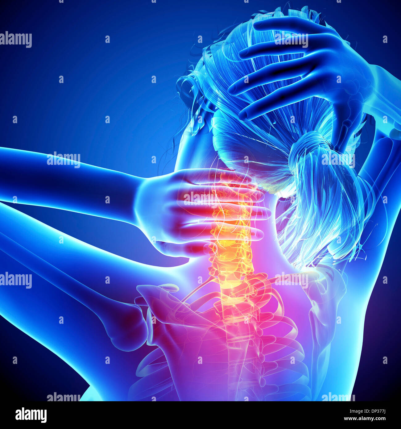 Radiografia anormale del collo immagini e fotografie stock ad alta ...