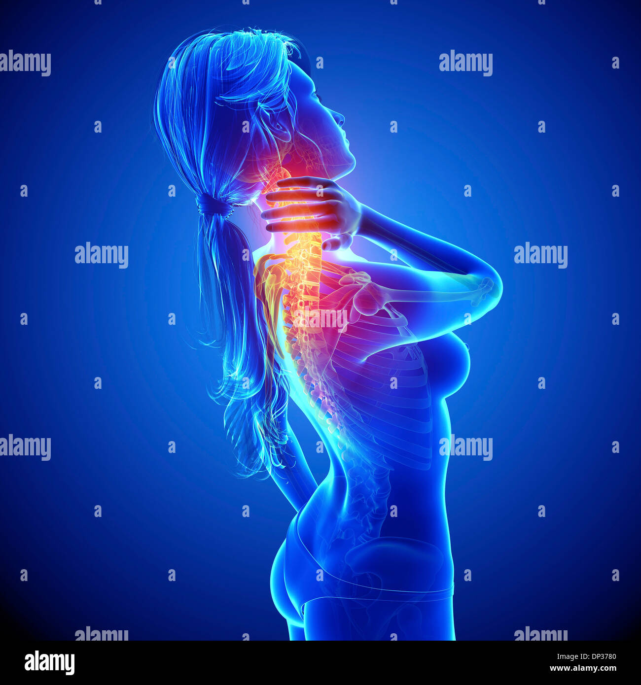 Radiografia anormale del collo immagini e fotografie stock ad alta ...