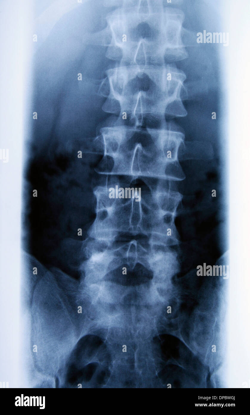 Dorso Lombare Immagini e Fotos Stock - Alamy