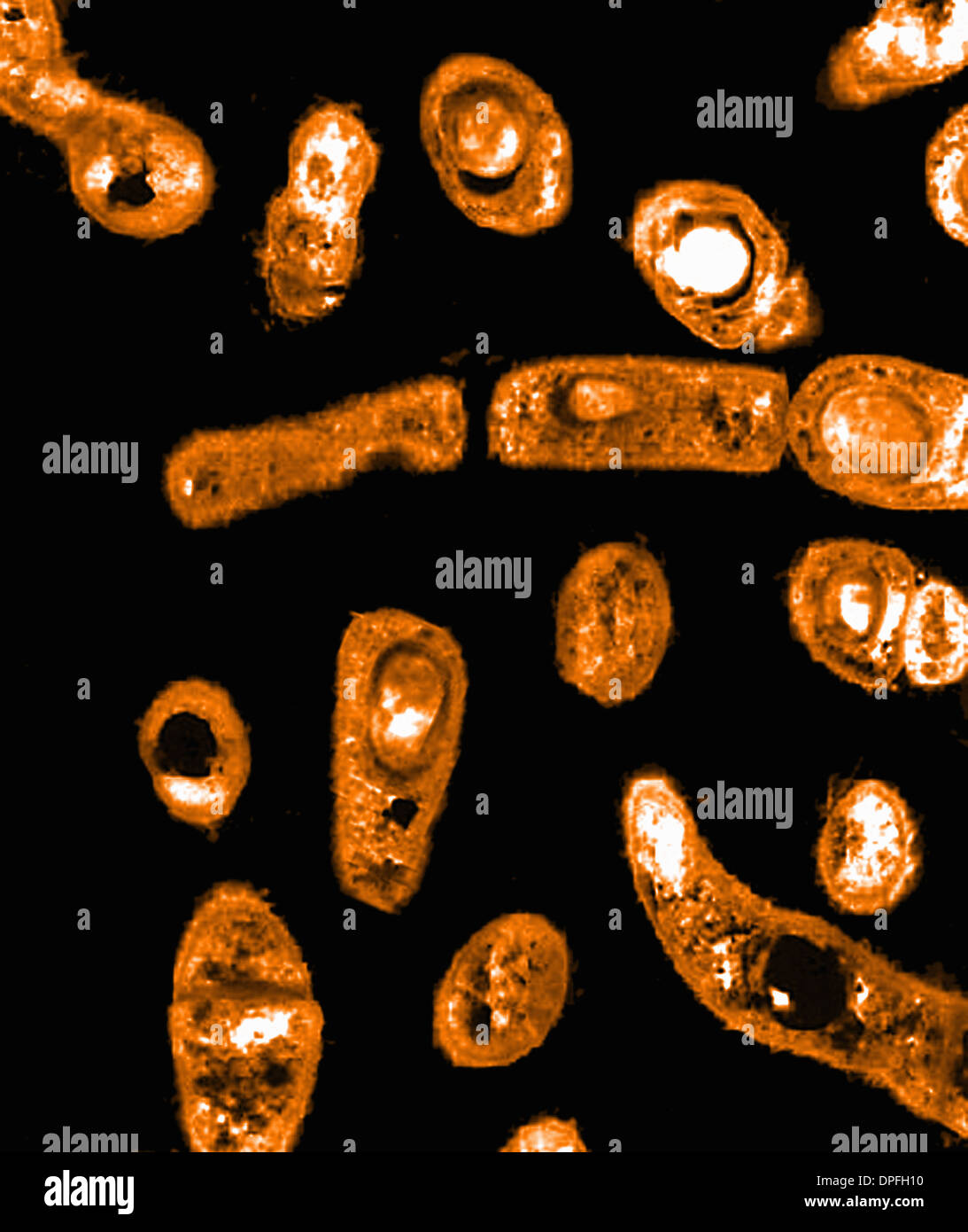 Bacillus anthracis immagini e fotografie stock ad alta risoluzione - Alamy