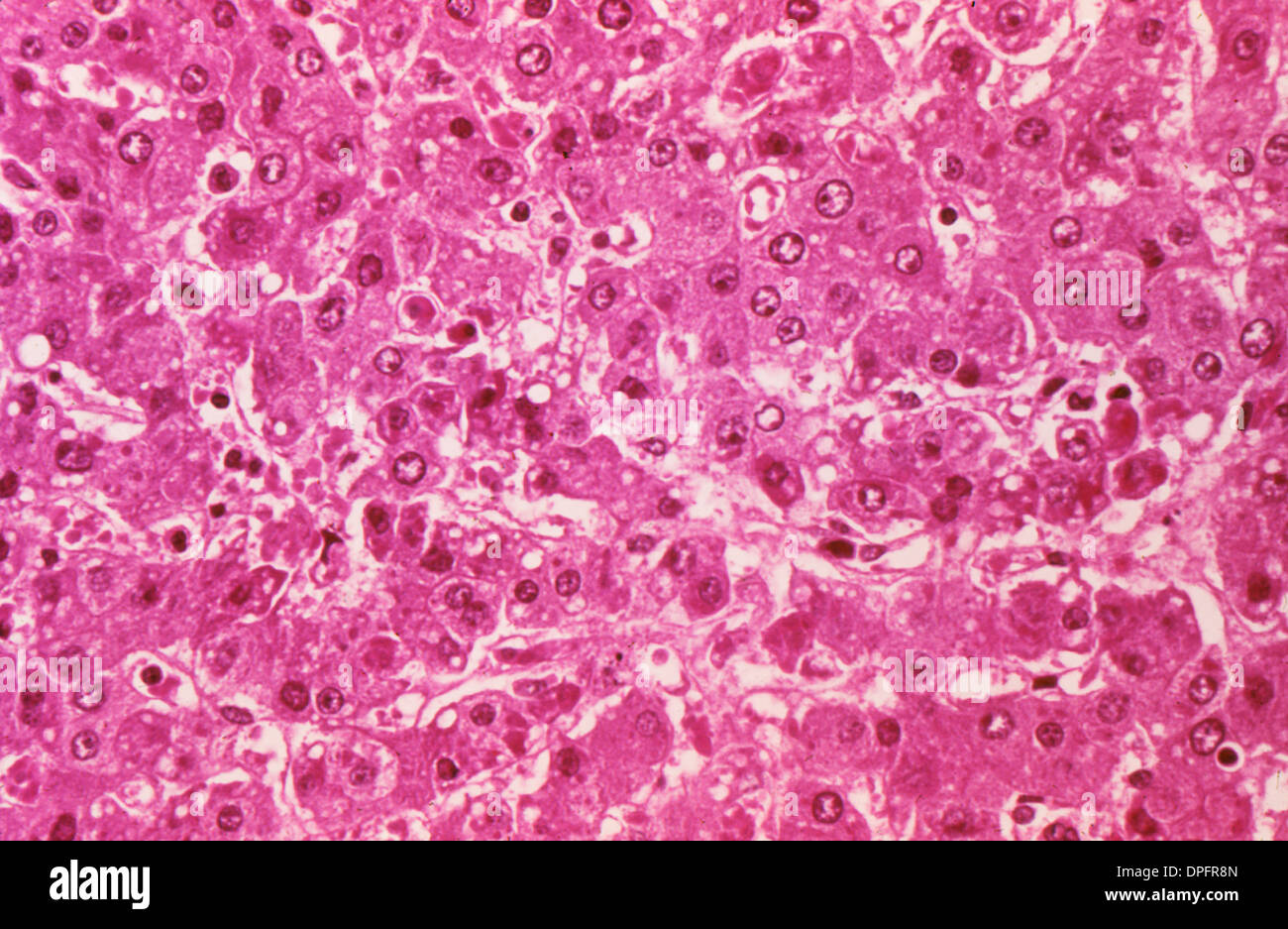 Micrografia leggera immagini e fotografie stock ad alta risoluzione - Alamy