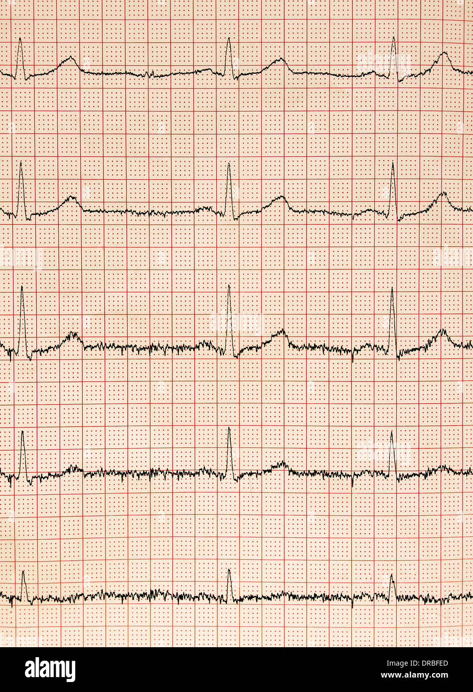 Elettro medicina immagini e fotografie stock ad alta risoluzione - Alamy