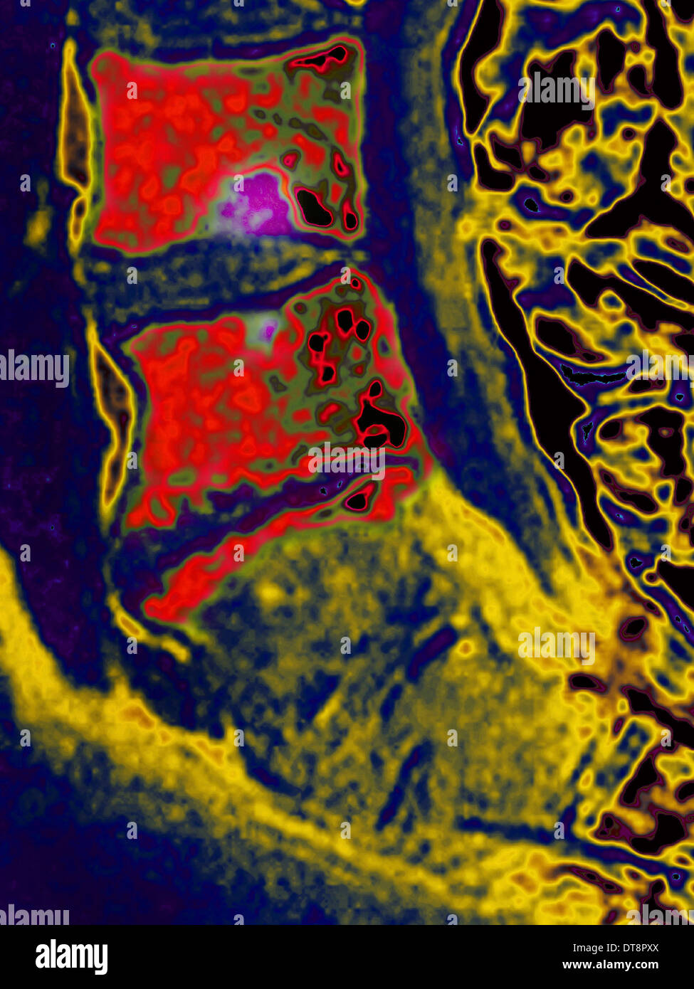 Tecniche di risonanza magnetica immagini e fotografie stock ad alta ...