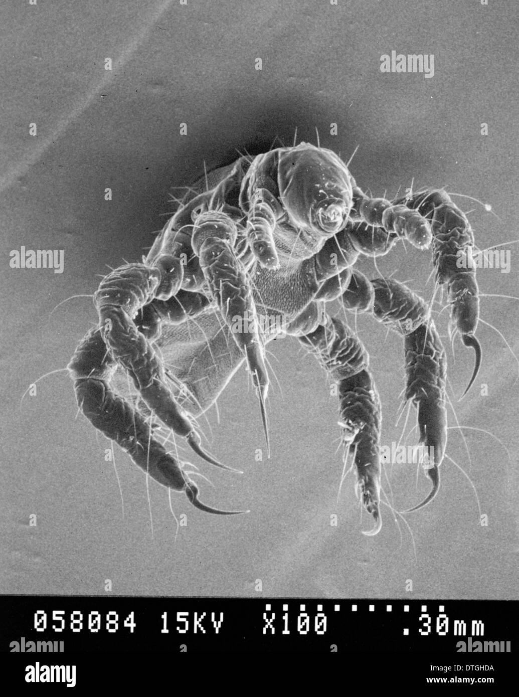 Pidocchio della testa umana immagini e fotografie stock ad alta ...