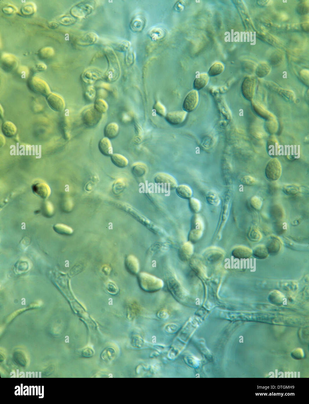 Nostoc algae green algae immagini e fotografie stock ad alta ...