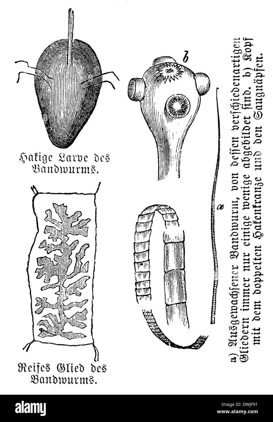 Taenia solium immagini e fotografie stock ad alta risoluzione - Alamy