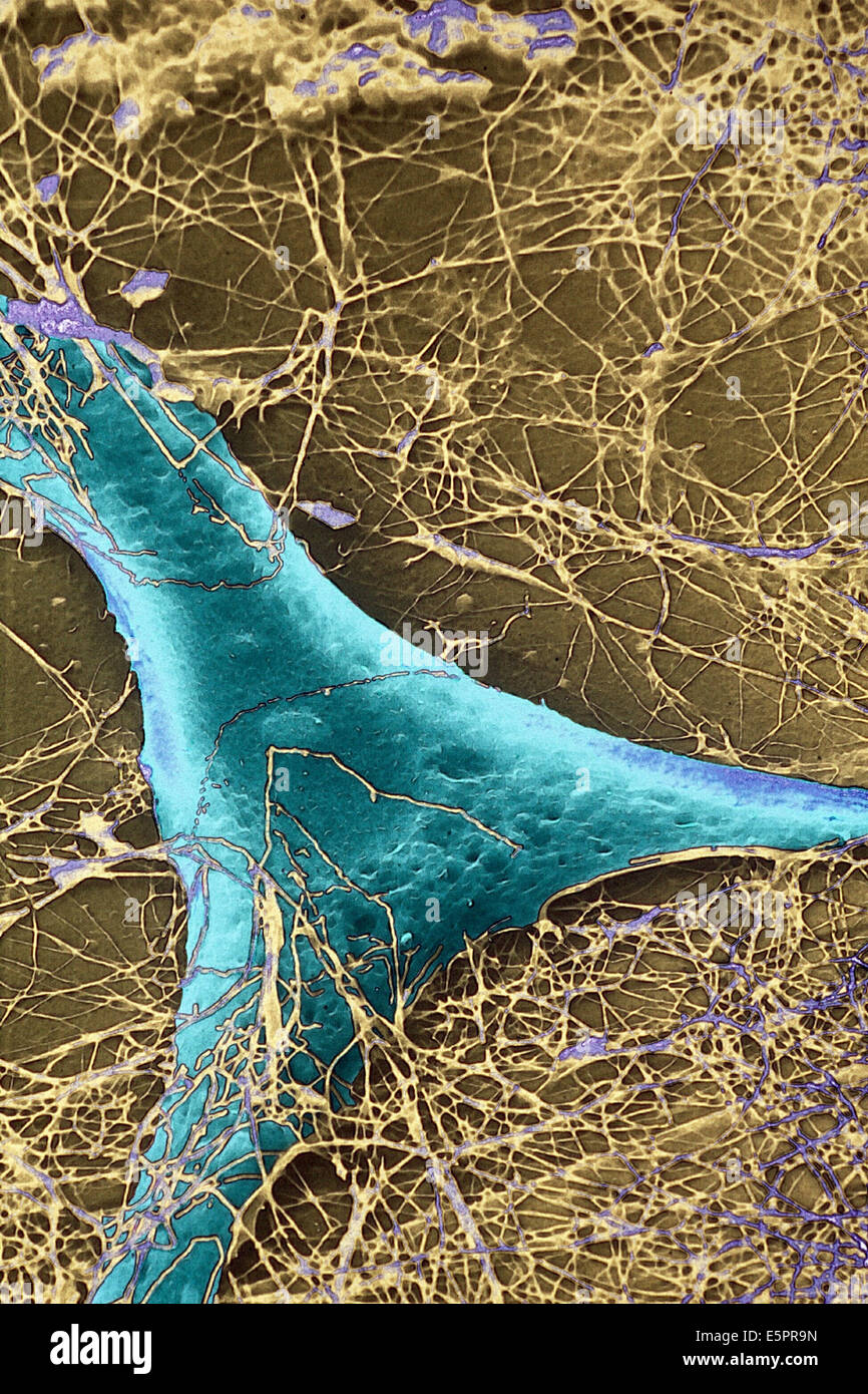 Fibroblasto e le fibre di collagene ESM (Scanning Electron Microscope ...