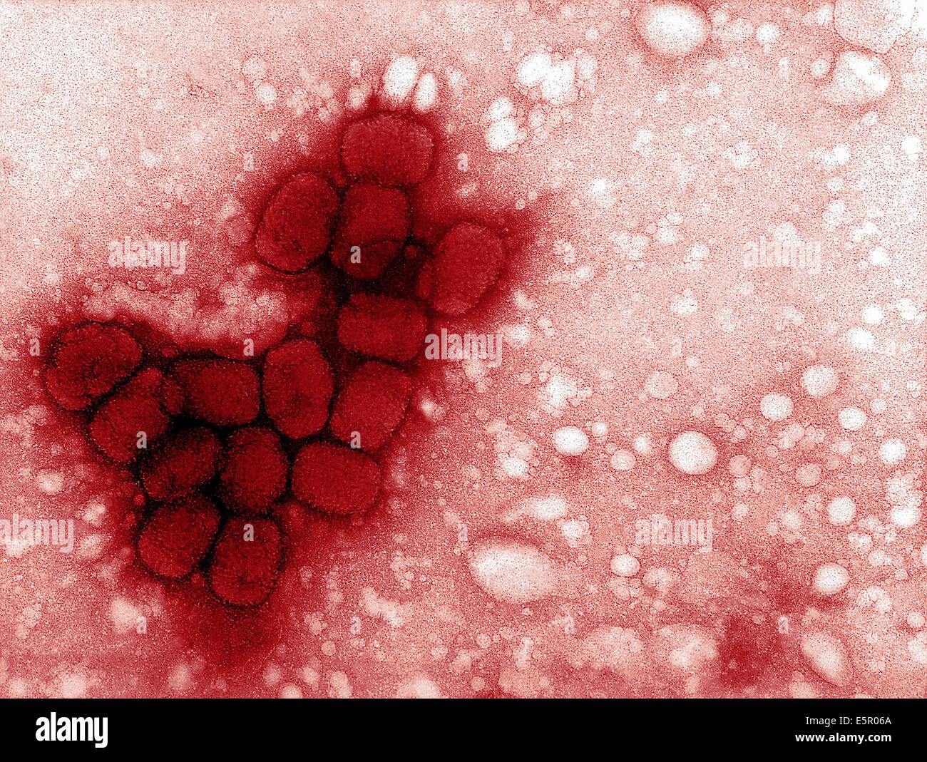 Virus del vaiolo immagini e fotografie stock ad alta risoluzione - Alamy