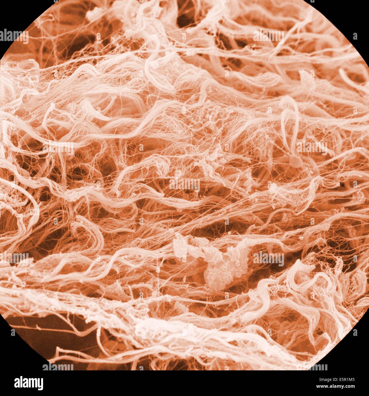 Collagene microscopio elettronico immagini e fotografie stock ad alta risoluzione - Alamy