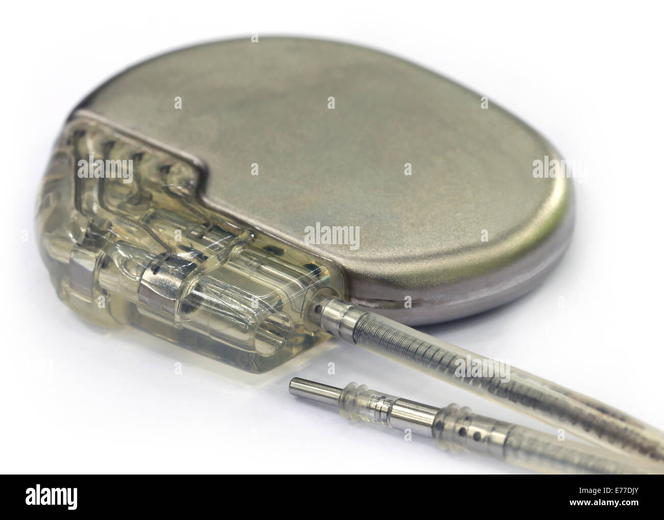 Cardiac pacemaker immagini e fotografie stock ad alta risoluzione - Alamy
