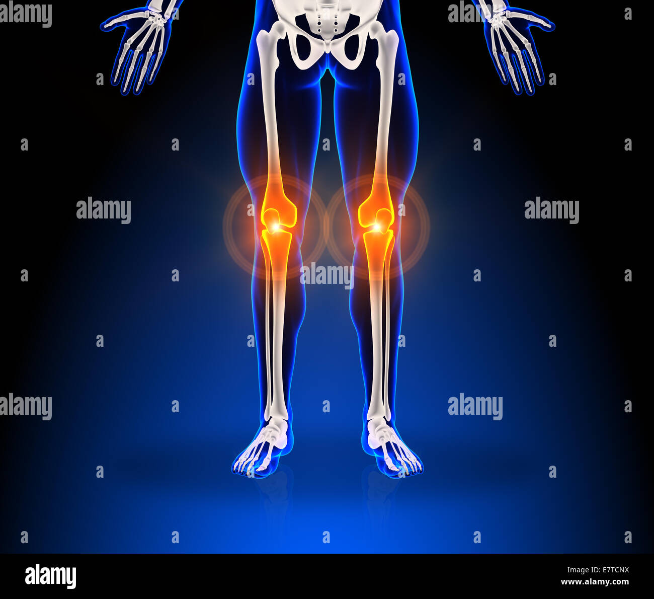 Dolore articolare umano immagini e fotografie stock ad alta risoluzione ...