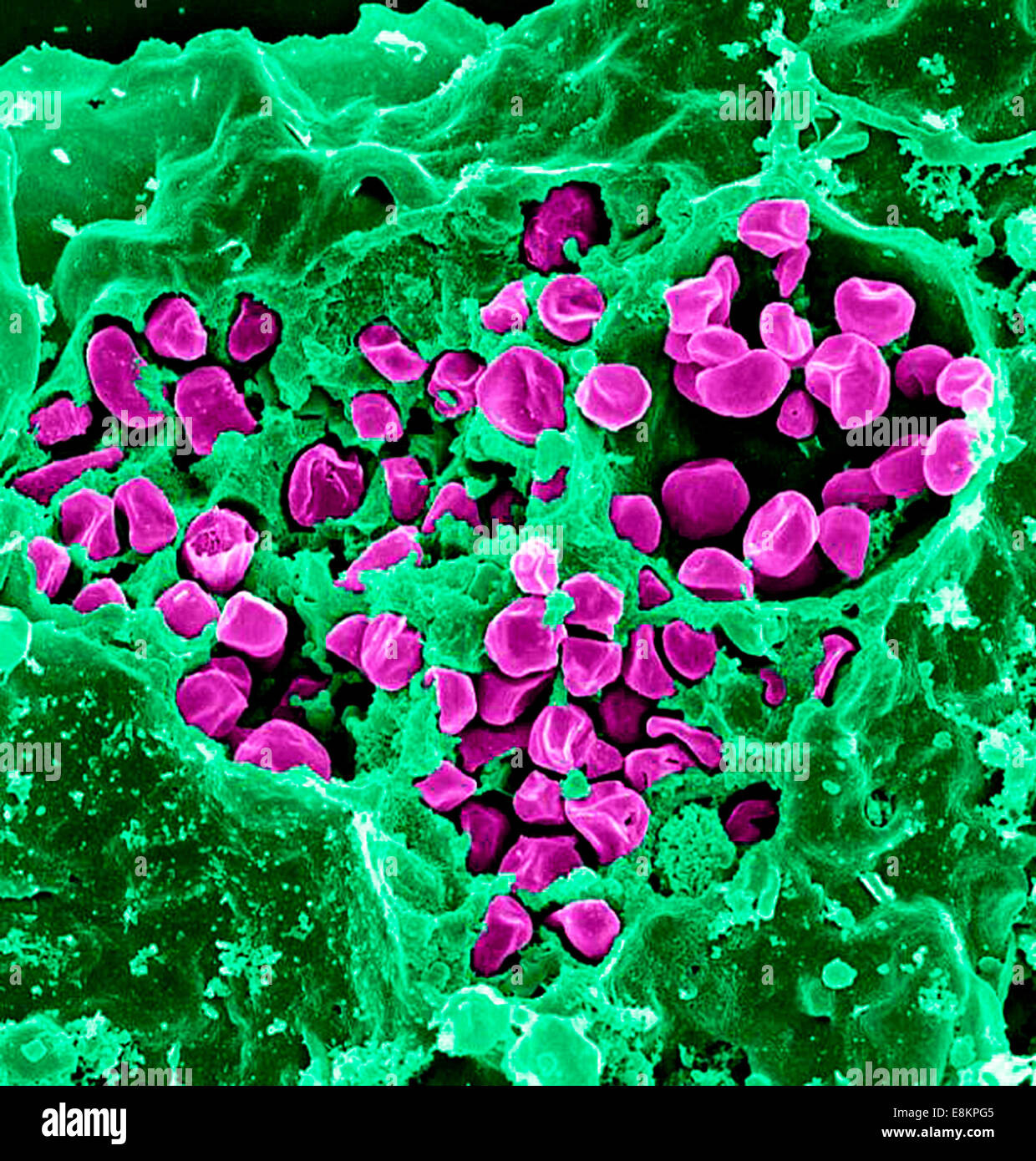 Macrophage sem immagini e fotografie stock ad alta risoluzione - Alamy