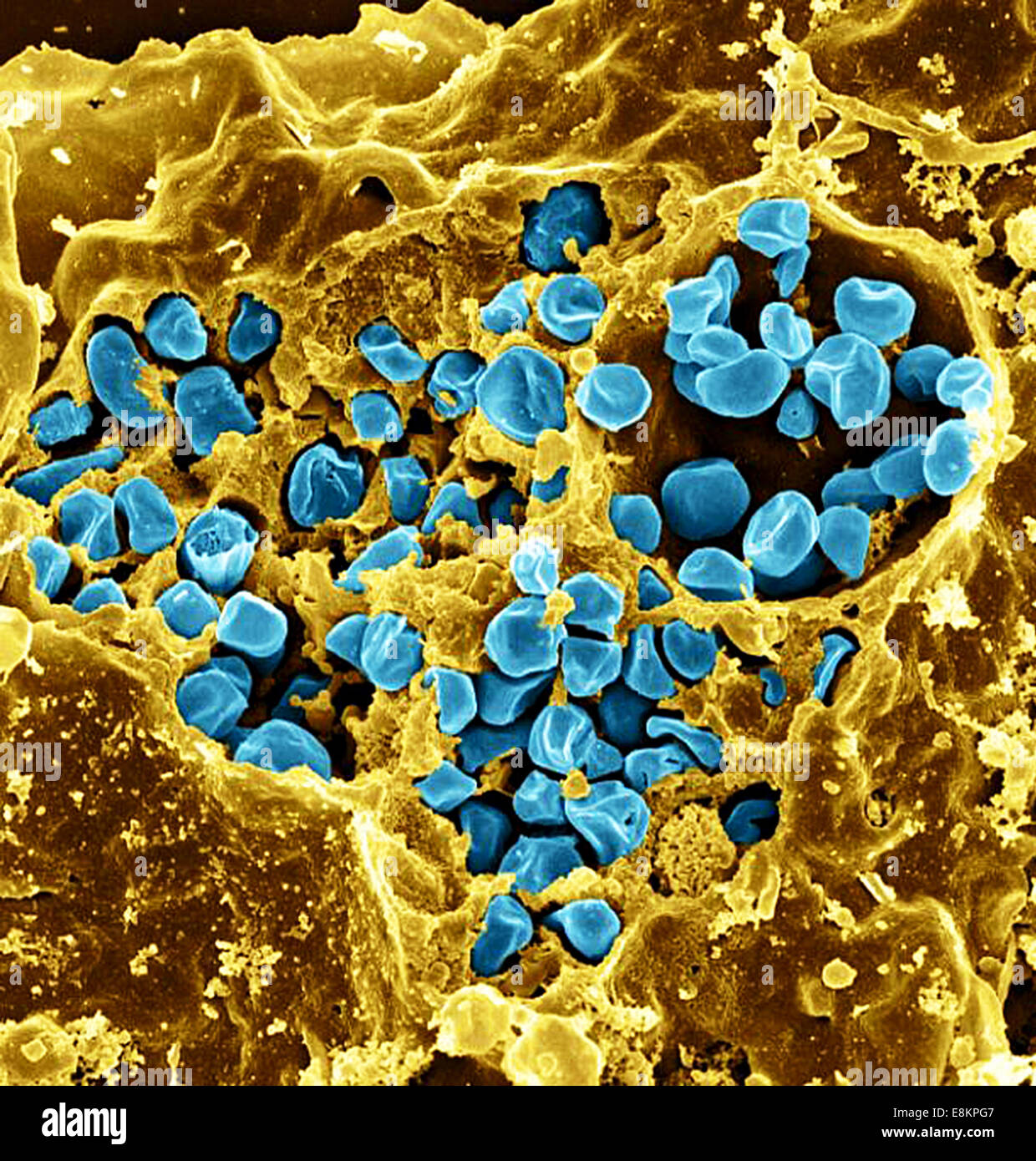 Macrophage sem immagini e fotografie stock ad alta risoluzione - Alamy