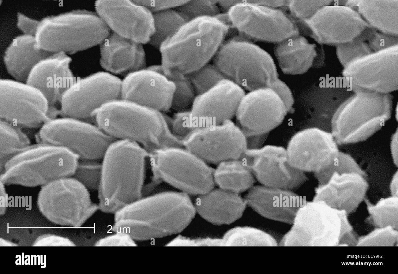 La fotomicrografia di Bacillus anthracis (antrace) spore Foto stock - Alamy