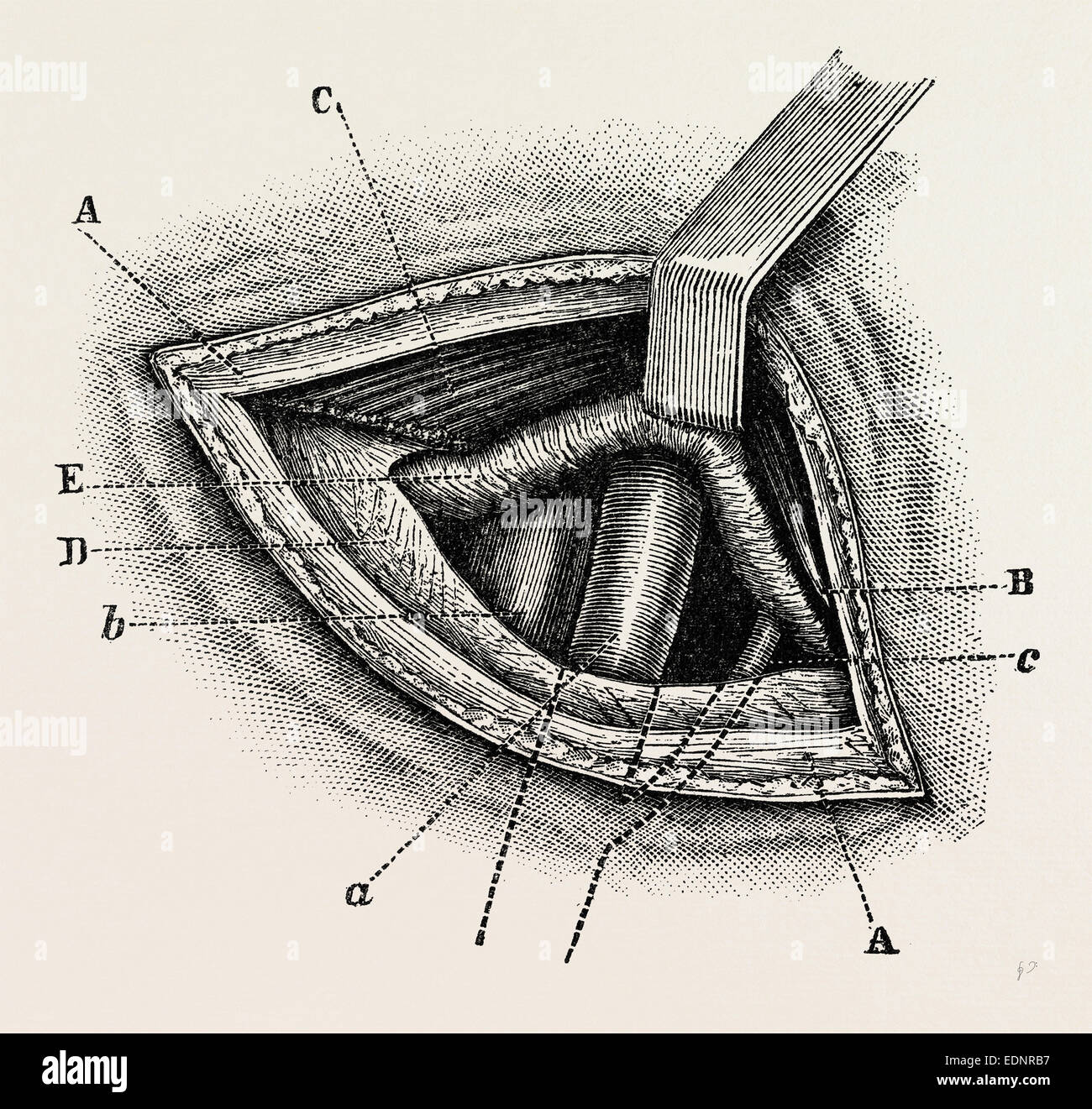 Arteria iliaca externa immagini e fotografie stock ad alta risoluzione ...