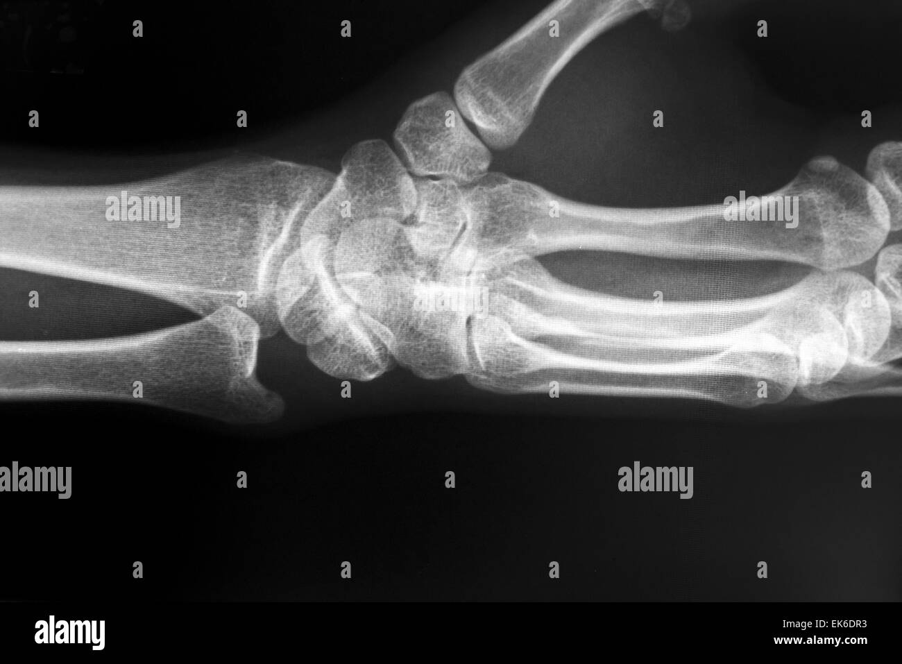 Immagini della mano umana immagini e fotografie stock ad alta ...