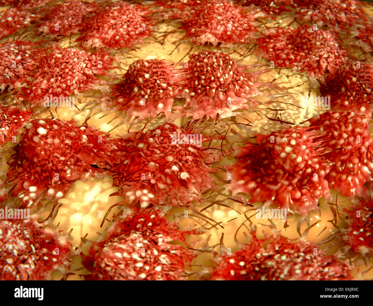 Artwork, illustrazione biomedica, cancro, cancro, cellule cancerose, la ...
