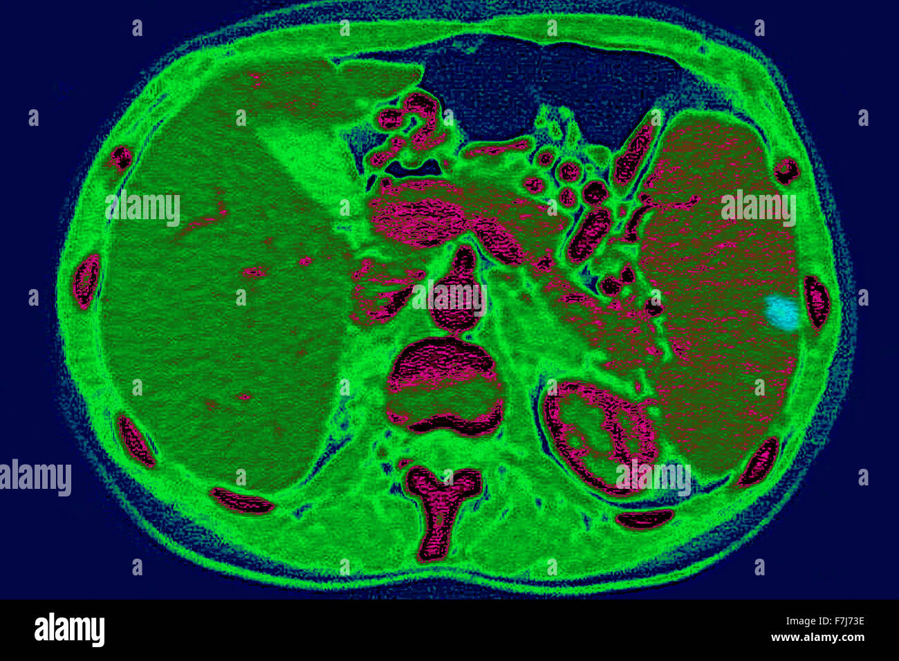 Ct scans immagini e fotografie stock ad alta risoluzione - Alamy