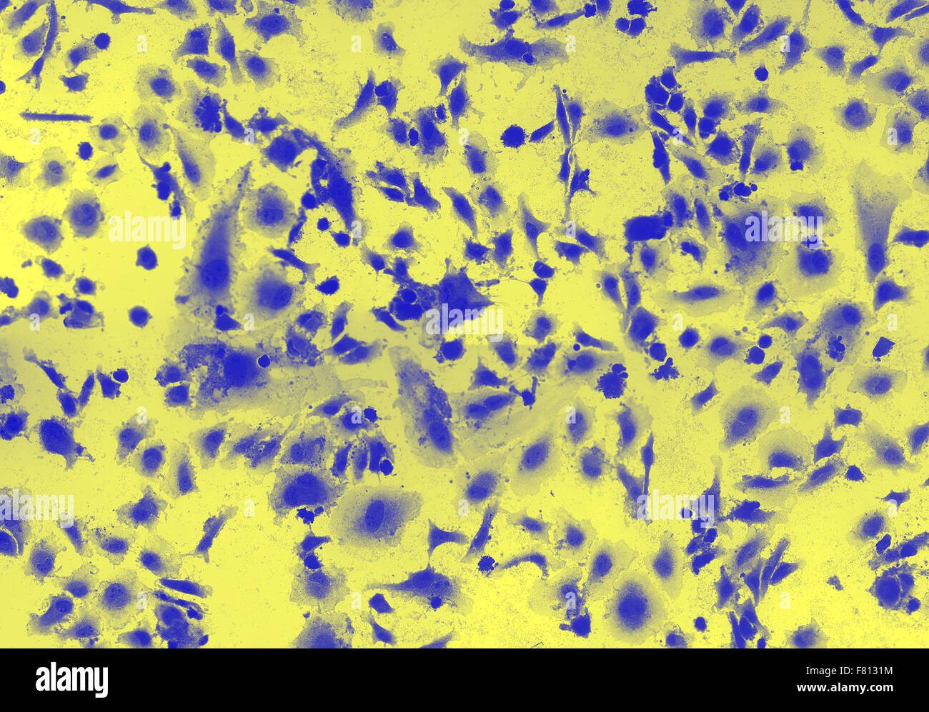 Cellule HeLa cellule di cancro della cervice, colorati con blu ...