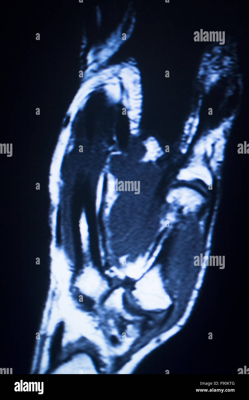 MRI magnetic resonance imaging medico prova di scansione che mostra i ...