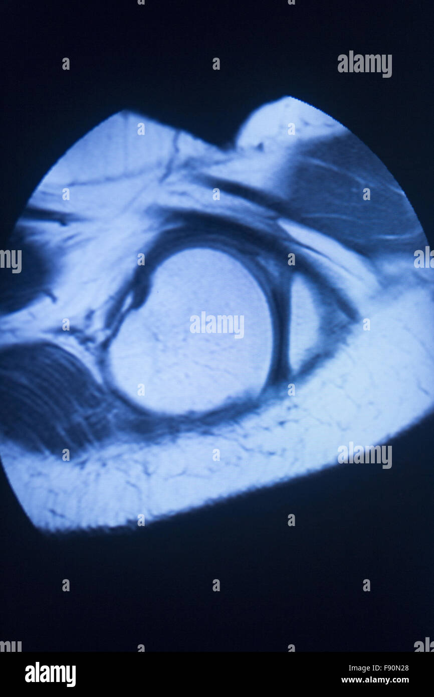 MRI magnetic resonance imaging medico prova di scansione che mostra i ...