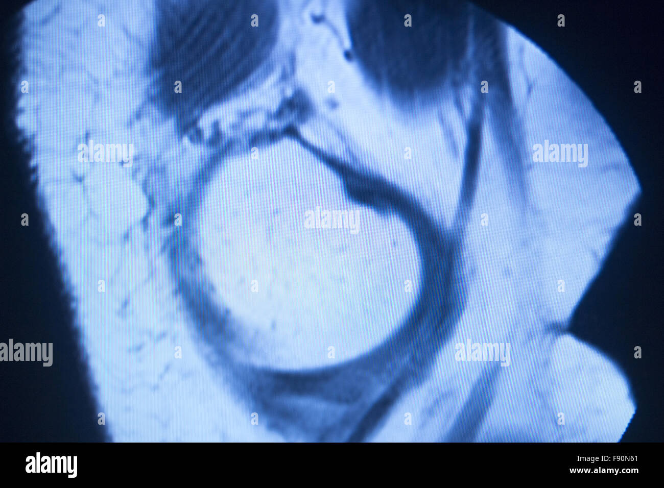 MRI magnetic resonance imaging medico prova di scansione che mostra i ... MRI magnetic resonance imaging medico prova di scansione che mostra i ...