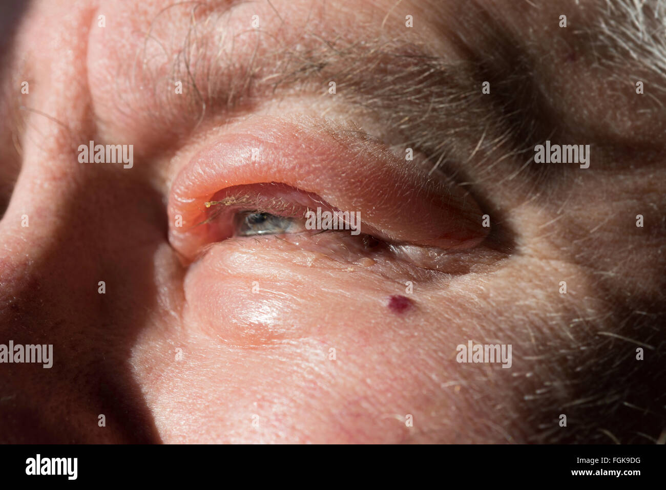 Palpebra palpebra immagini e fotografie stock ad alta risoluzione - Alamy