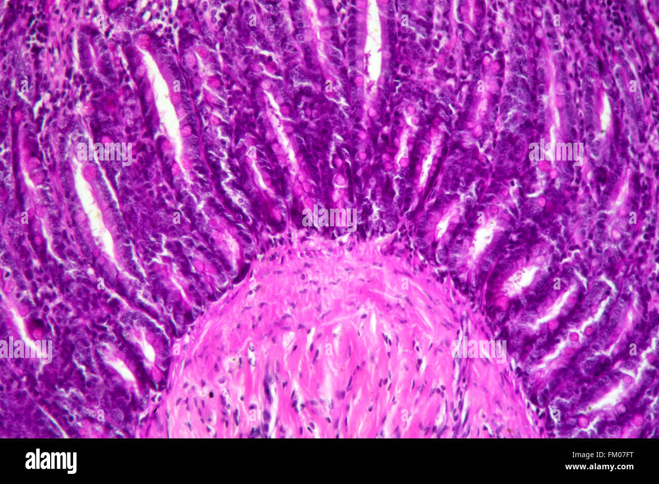 Istologico dell'intestino tenue immagini e fotografie stock ad alta ...