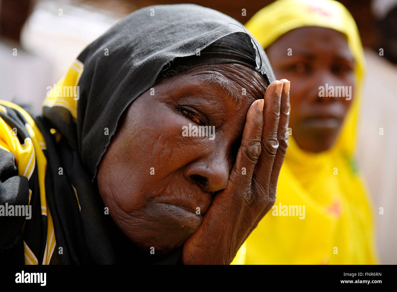 Malattia Di Lebbra Immagini e Fotos Stock - Alamy