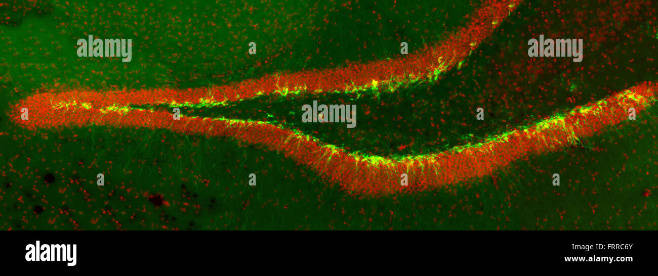 I nuovi nati i neuroni nel topo transgenico ippocampo (dentato gyrus ...