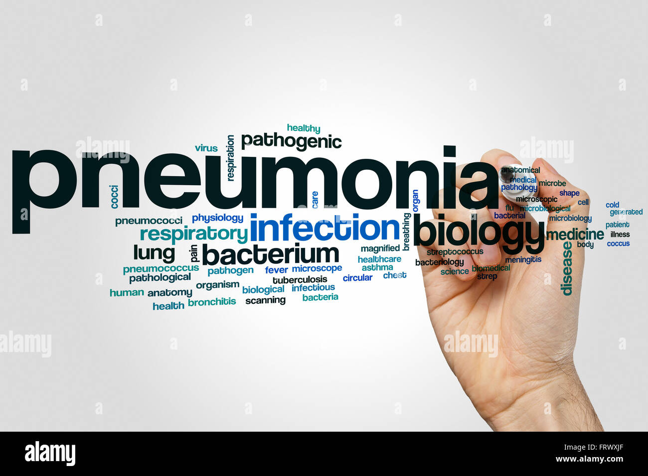 Polmonite batterica immagini e fotografie stock ad alta risoluzione - Alamy