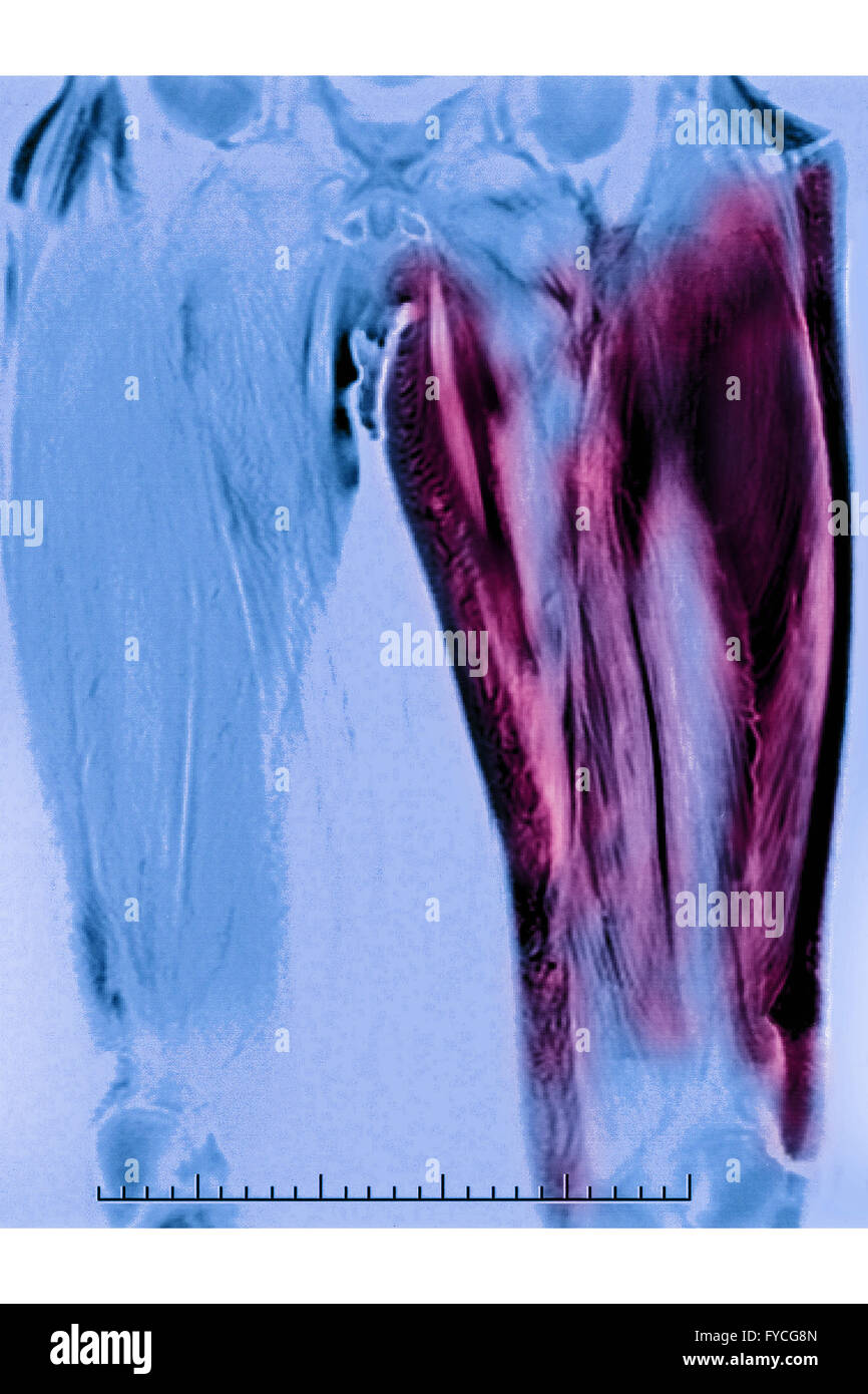 Nella coscia immagini e fotografie stock ad alta risoluzione - Alamy