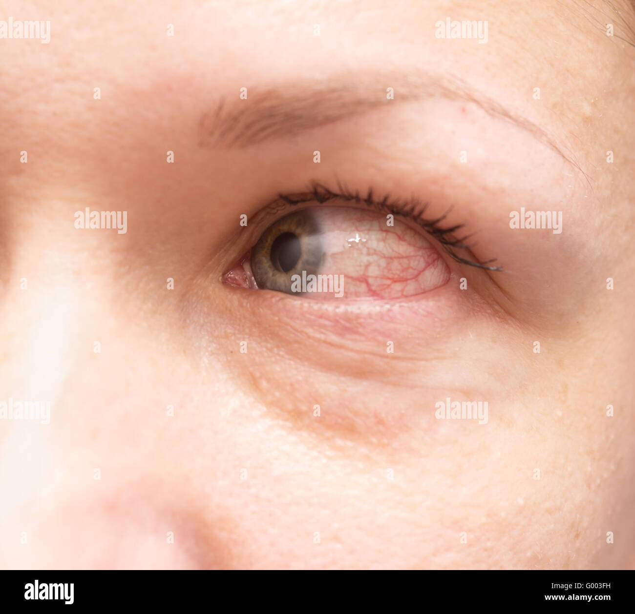 Occhio esausto immagini e fotografie stock ad alta risoluzione - Alamy