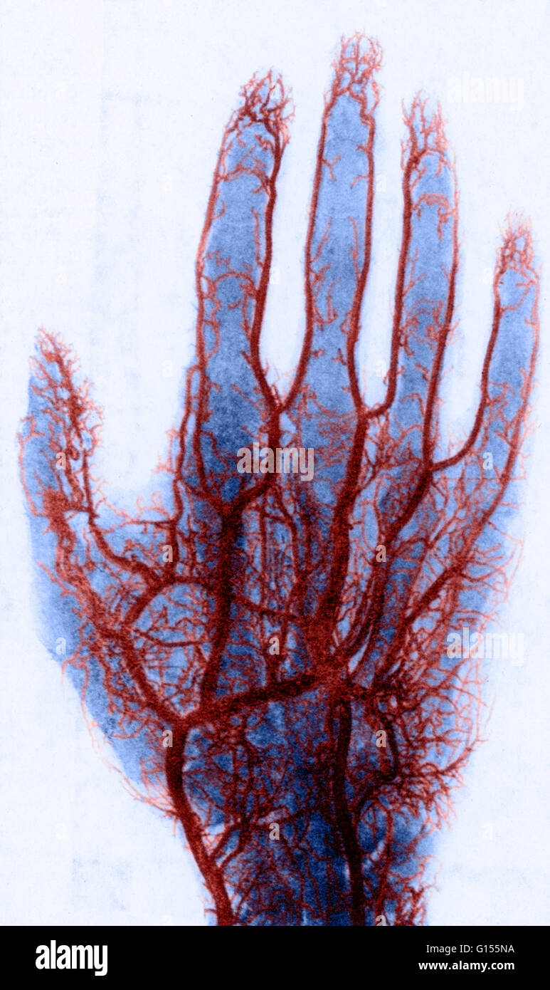 Radiografia dei vasi sanguigni immagini e fotografie stock ad alta ...