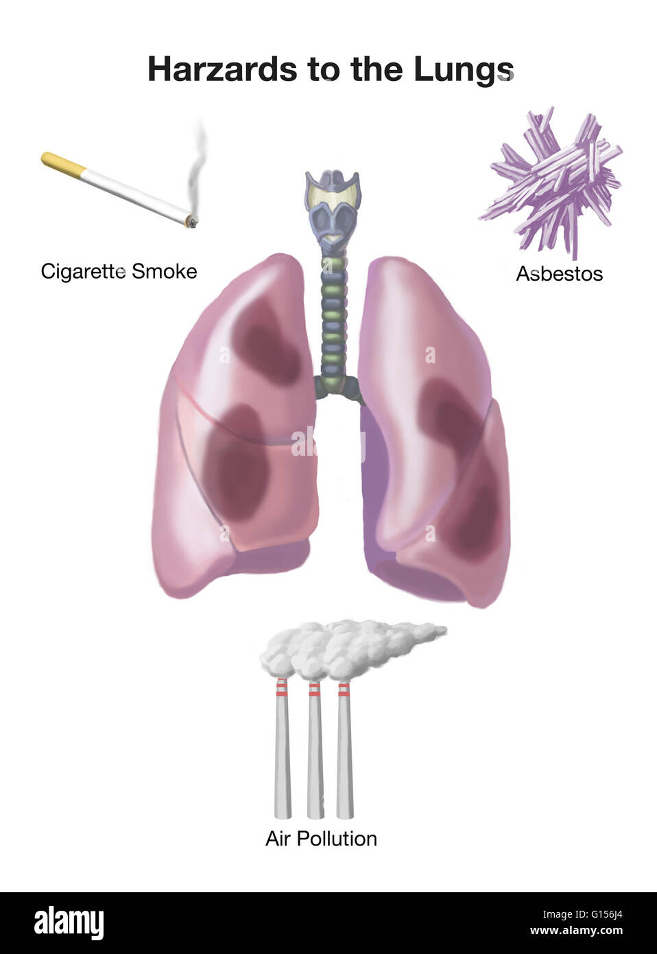 Inquinamento atmosferico infografiche immagini e fotografie stock ad alta risoluzione - Alamy