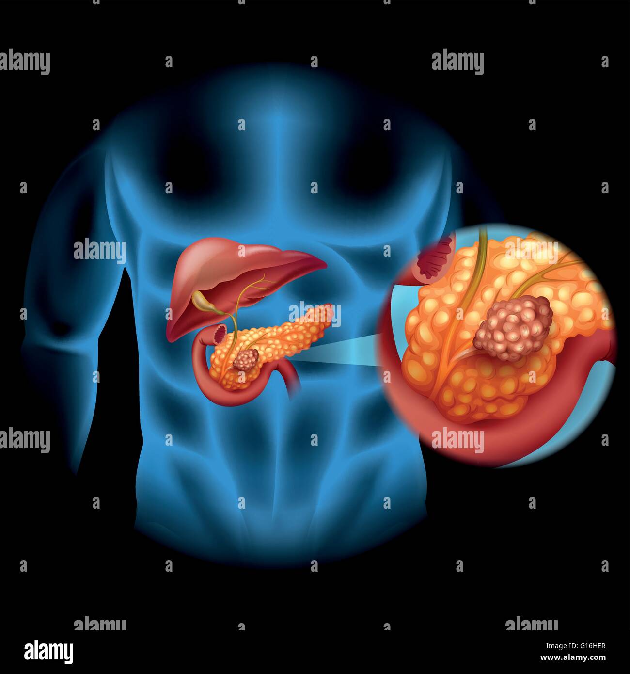 Anatomia del fegato e del pancreas Immagini Vettoriali Stock - Pagina 3 ...
