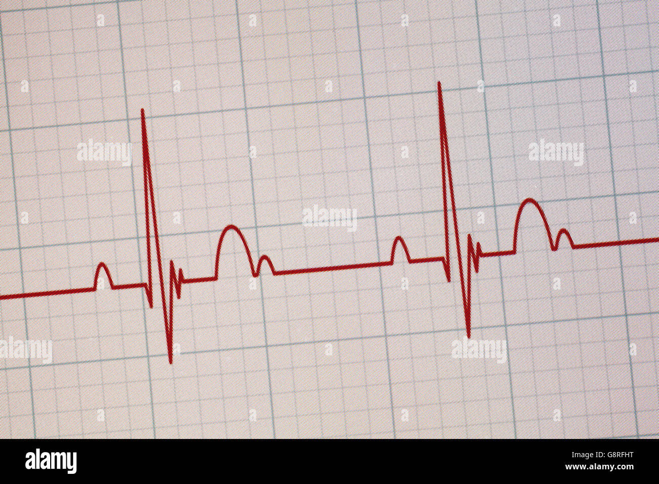 Traccia di cuore ecg immagini e fotografie stock ad alta risoluzione ...