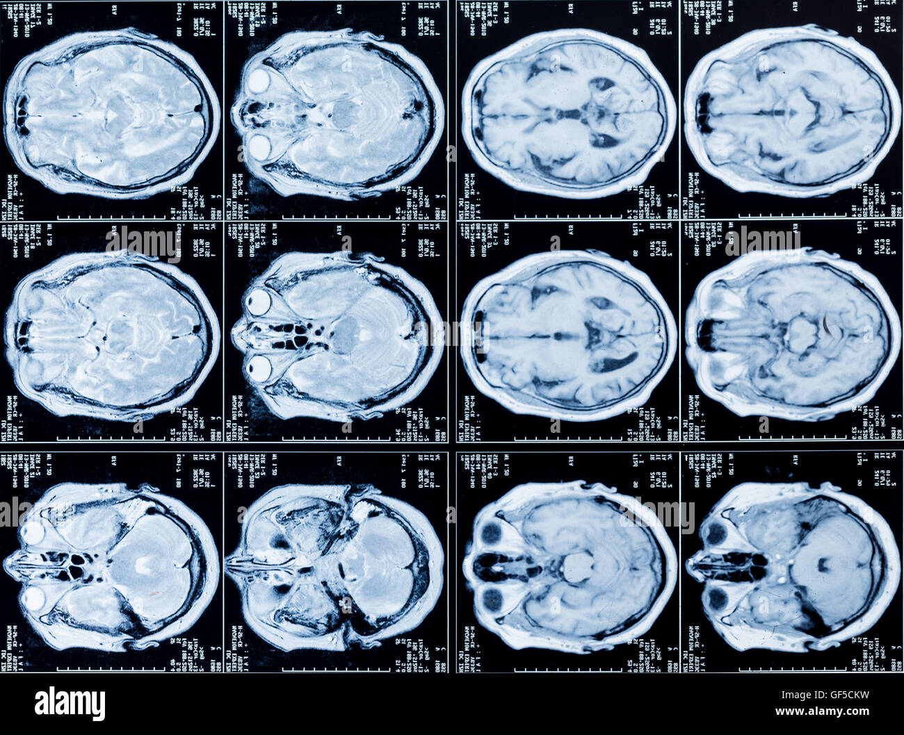Pet scan immagini e fotografie stock ad alta risoluzione - Alamy