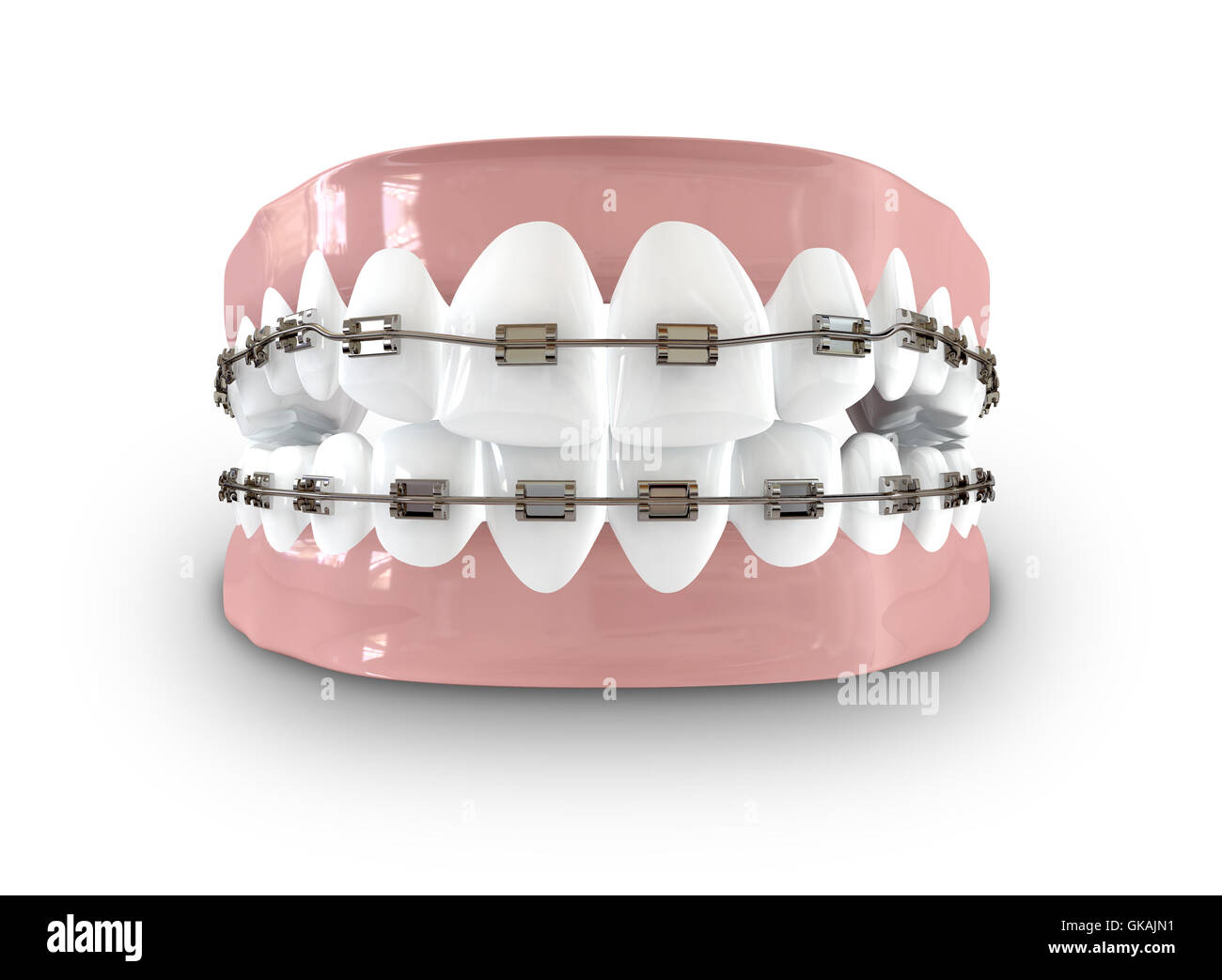 Denti canini superiori immagini e fotografie stock ad alta risoluzione ...