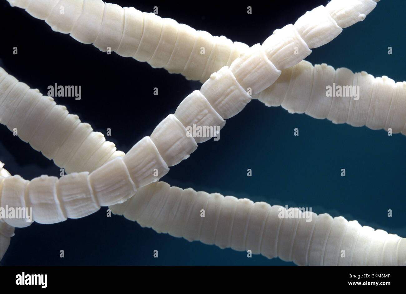 Taenia Solium Immagini e Fotos Stock - Alamy