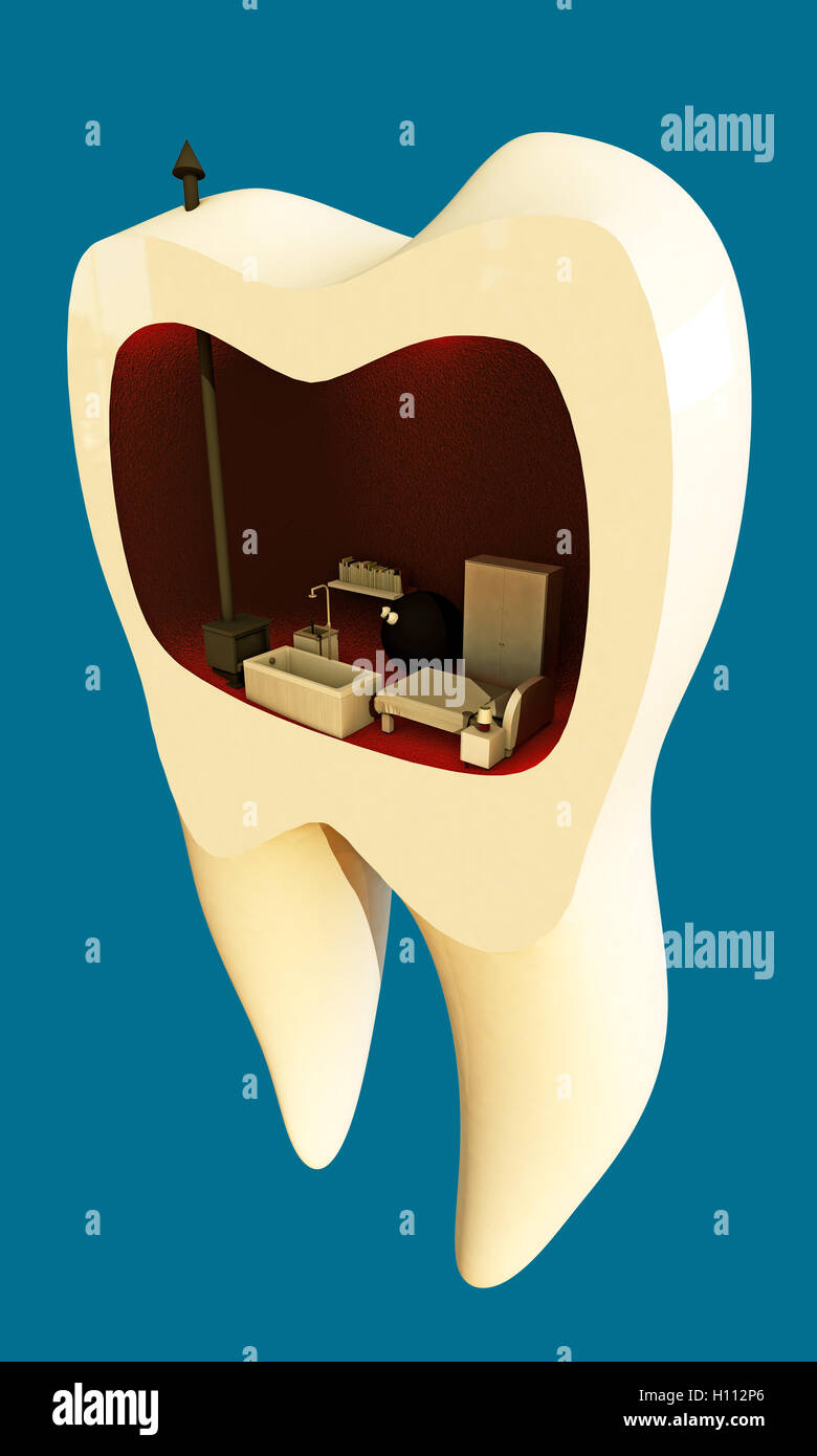 Radice del dente immagini e fotografie stock ad alta risoluzione - Alamy