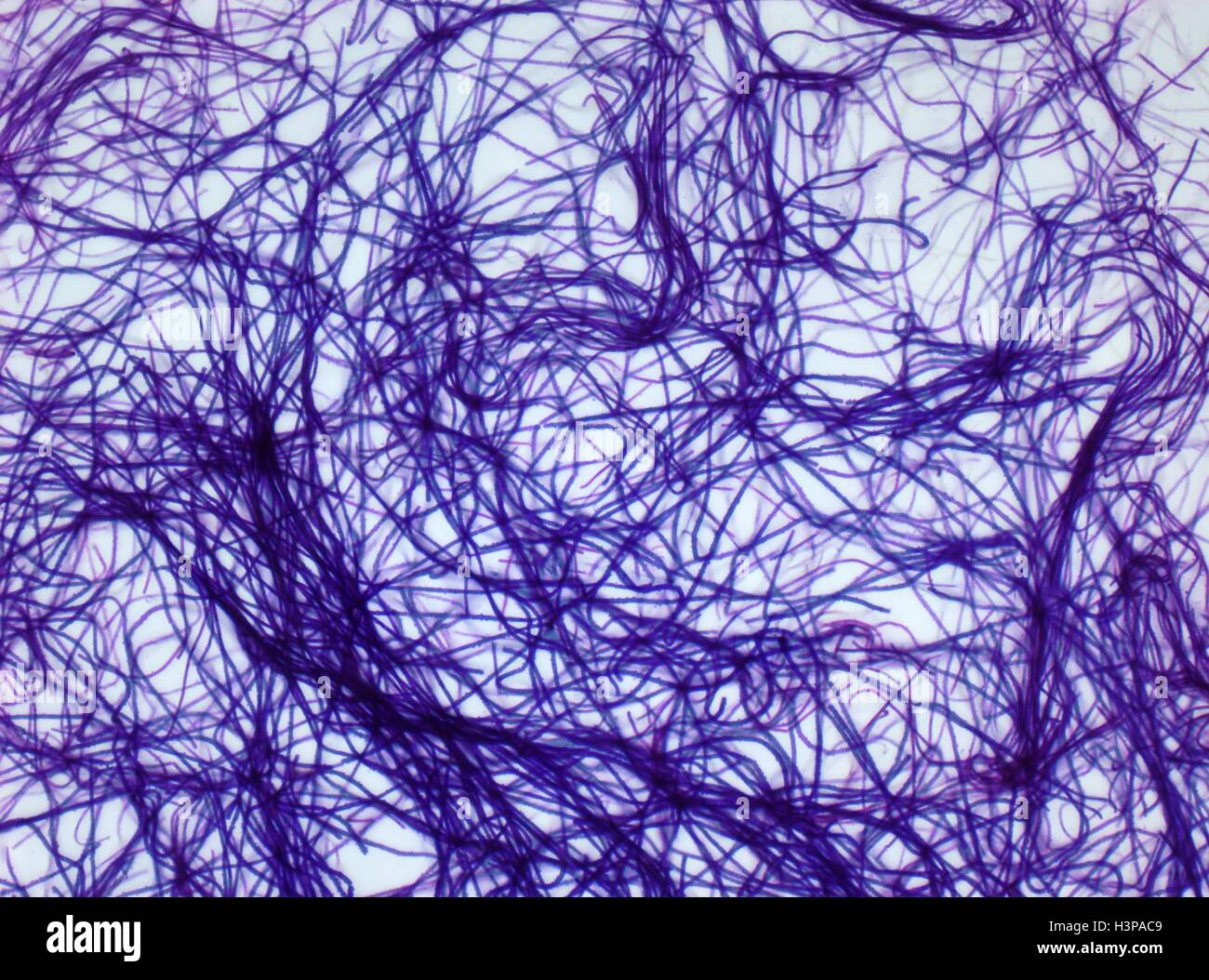 Pustola maligna immagini e fotografie stock ad alta risoluzione - Alamy