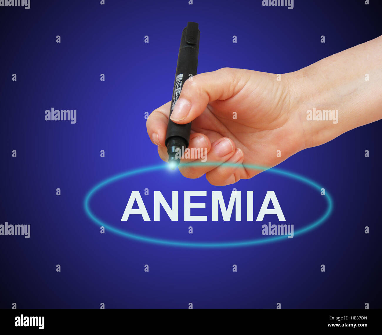 Anemia emolisi immagini e fotografie stock ad alta risoluzione - Alamy