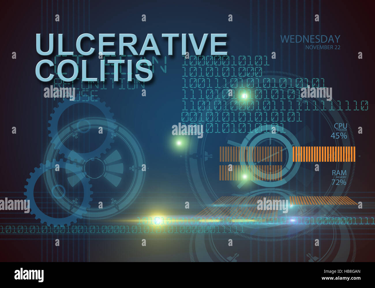 Colite ulcerosa immagini e fotografie stock ad alta risoluzione - Alamy