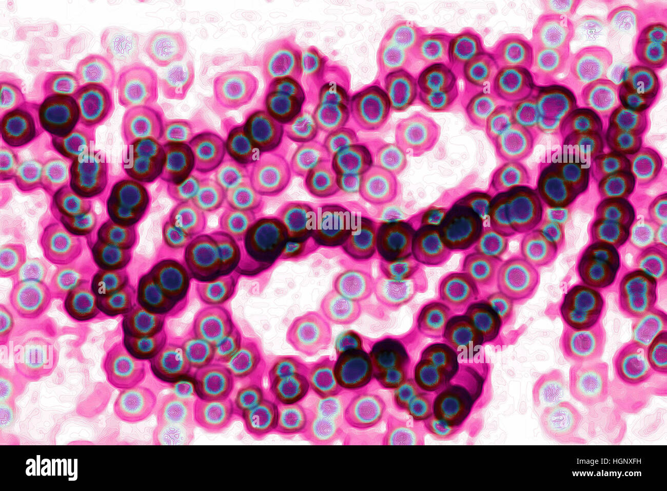 Streptococcus pyogenes gruppo a immagini e fotografie stock ad alta ...