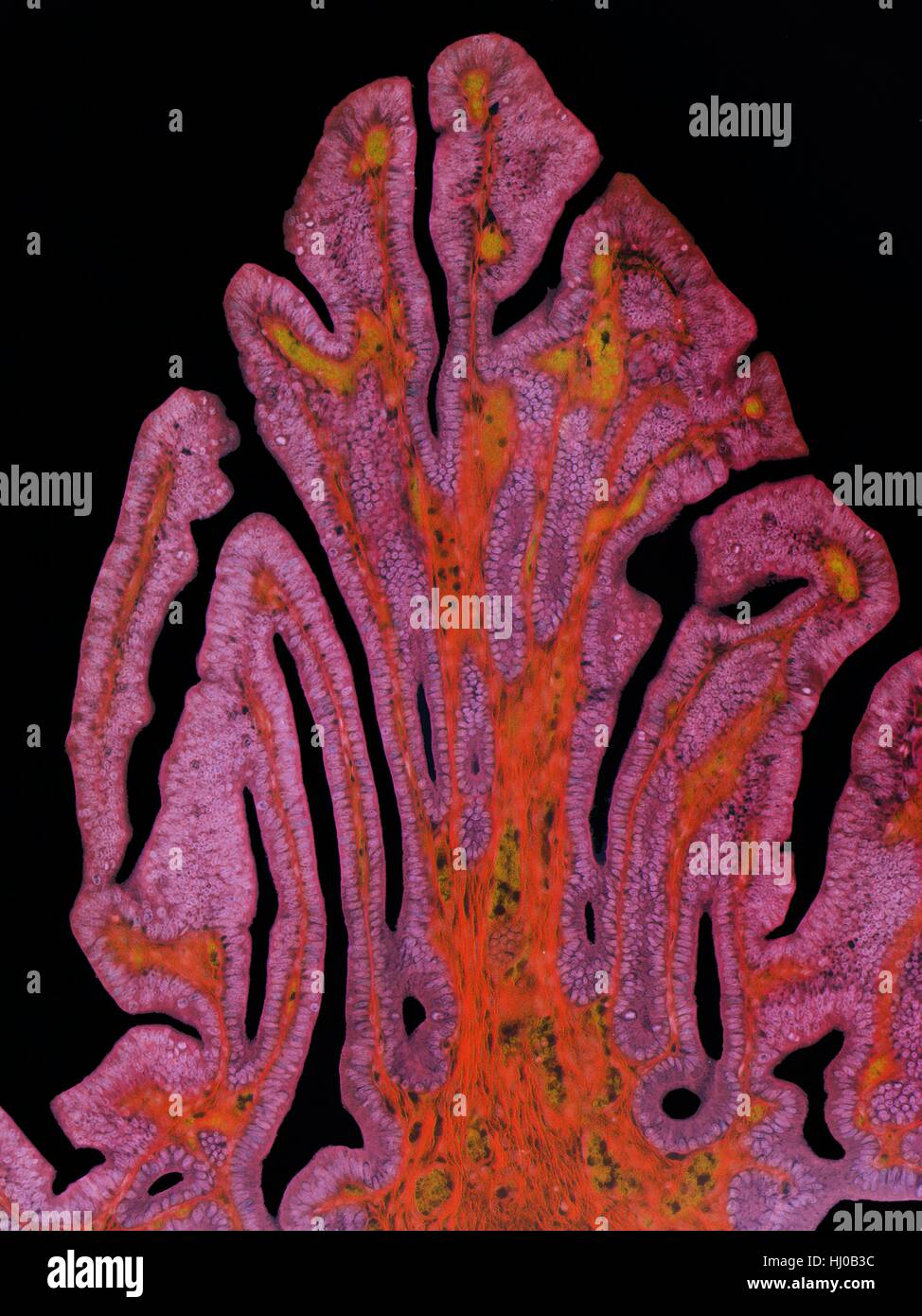 Falloppio ovaie immagini e fotografie stock ad alta risoluzione - Alamy