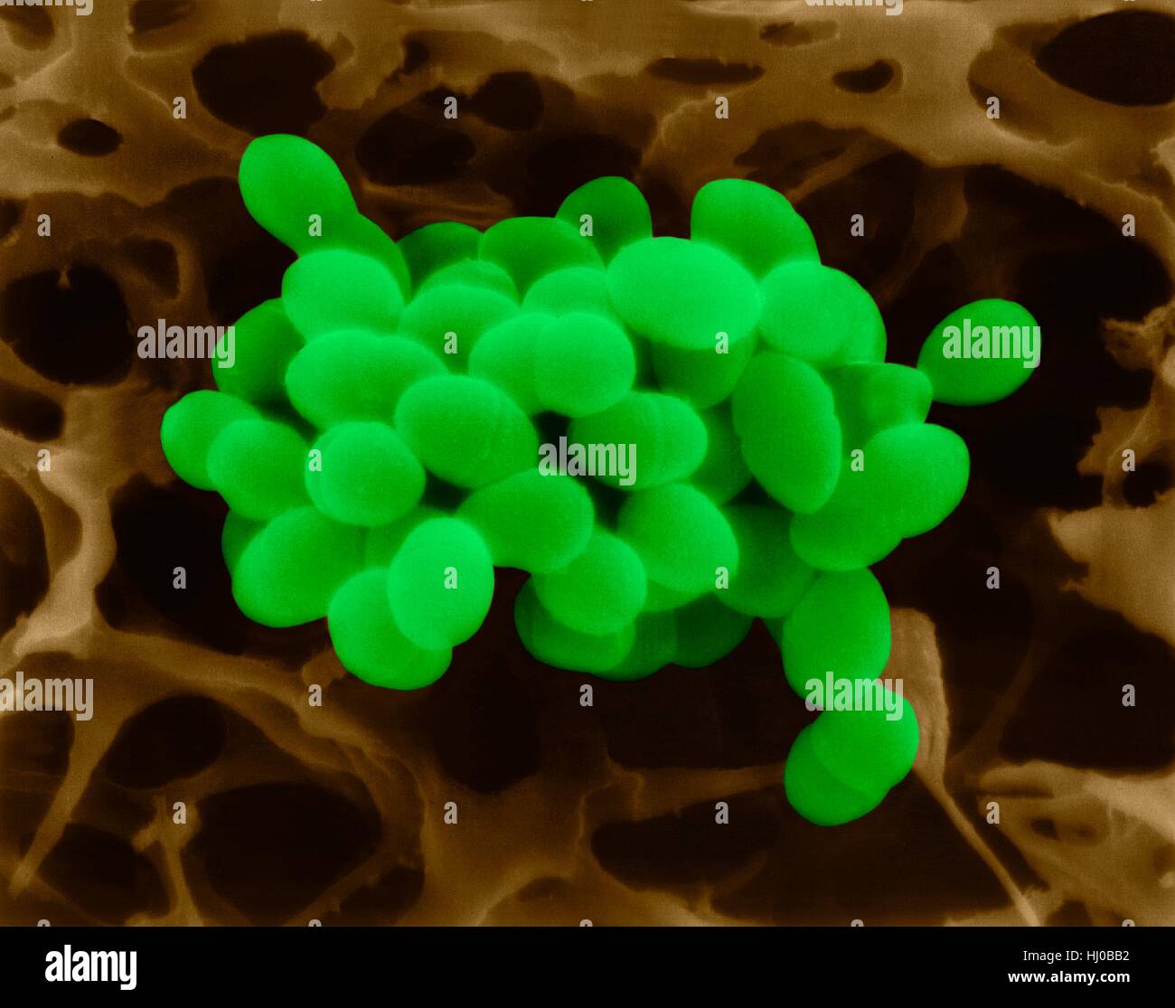 Color scanning electron microfotografia (SEM) di Enterococcus faecalis ...